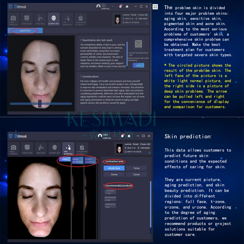 Portable Magic Mirror for 3D Smart Professional Skin Detection Analyzer ...