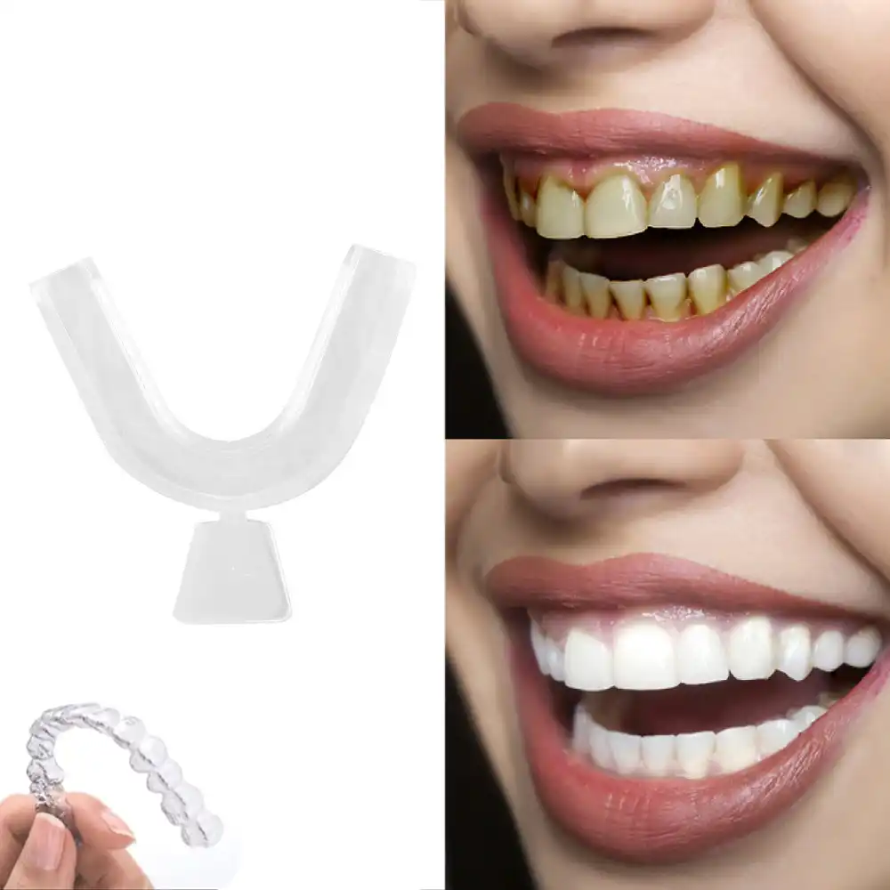 Капы Для Выравнивания Зубов Фото Цена – Telegraph