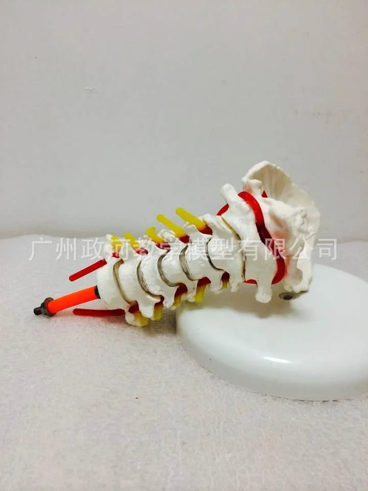 V-rtebra-cervical-com-modelo-de-art-ria-car-tida-occipital-e-7-v ...