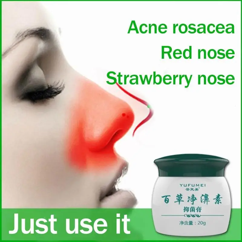 Anti Nose Mites Cream Red Herbal Rosacea Ointment Acne Remo 海外限定
