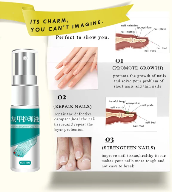 Nail Fungal Treatment Feet Care Essence Nail Foot Whitening Toe Nail ...