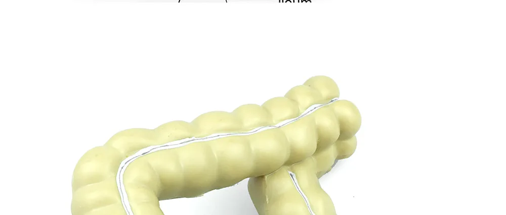 Colorectal Lesion Model Human Colon Snake Large Intestine Pathological ...