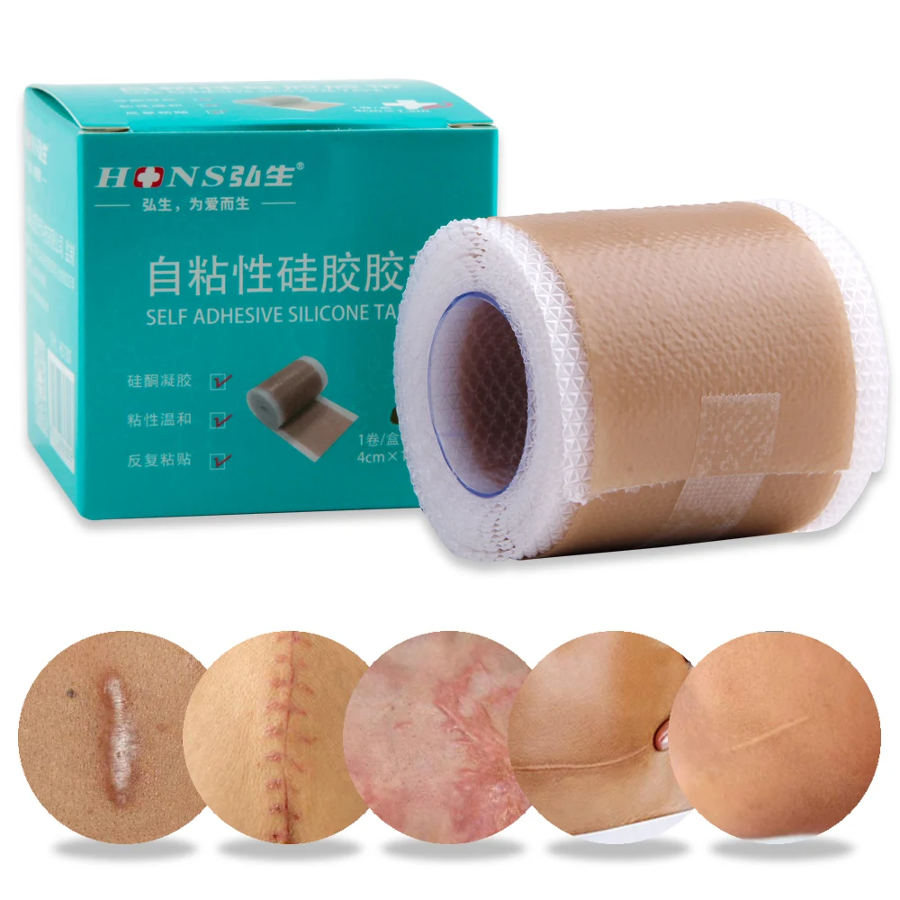 실리콘 흉터 패치 상처 밴드 여드름 화상 흉터 치료 커버 귀 교정기 효율적인 복구 손상된 피부 시트 4x50cm세트