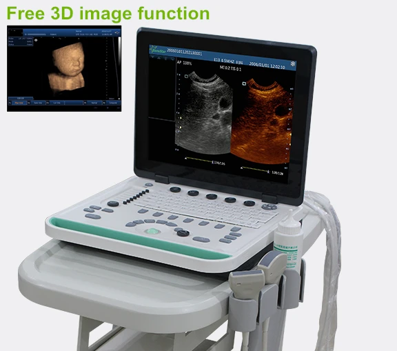 15in led humano b/w computador portátil 3d máquina do varredor do ...