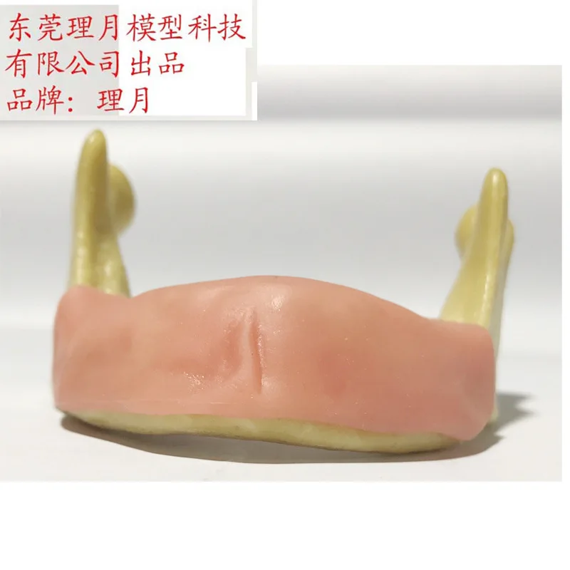 Bionic-Jaw-Bone-Gingival-Teeth-Oral-Cavity-Implant-Restoration ...