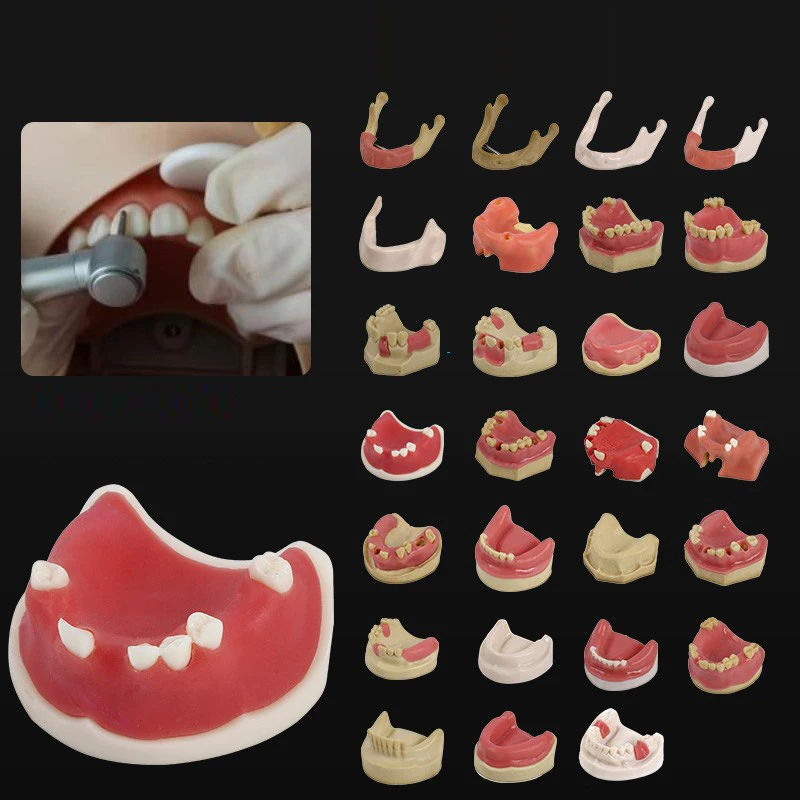 Mandibular model Dental Patient Communication Demonstration Oral Model ...