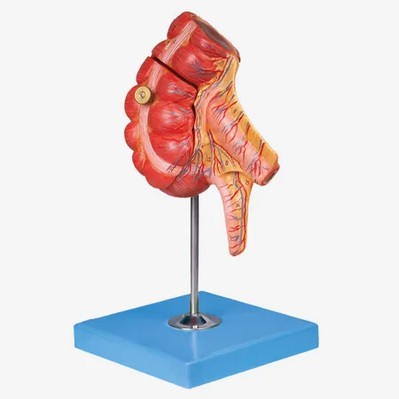 Anatomical Model Of Appendix And Caecum, Human Appendix - Medical ...