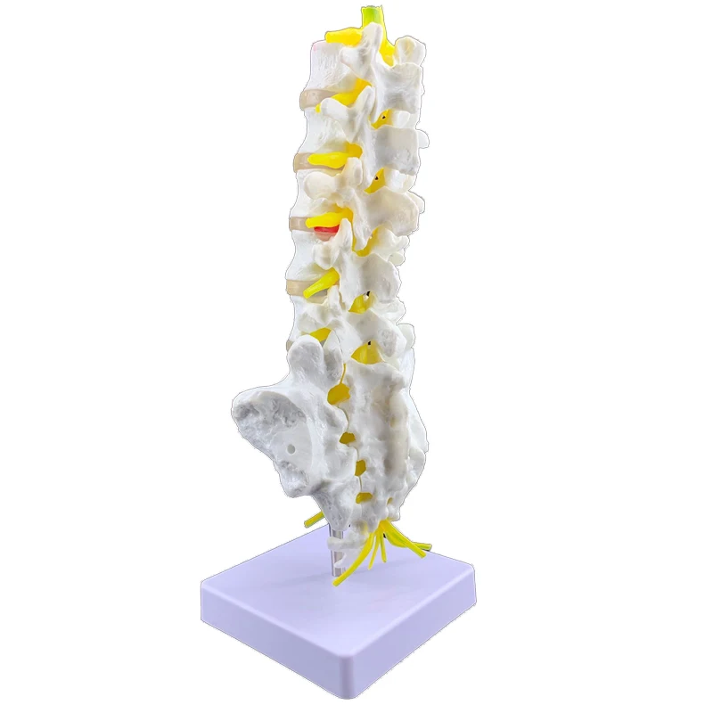 Natural Size Adult Five-section Lumbar Vertebrae Model Human Body ...
