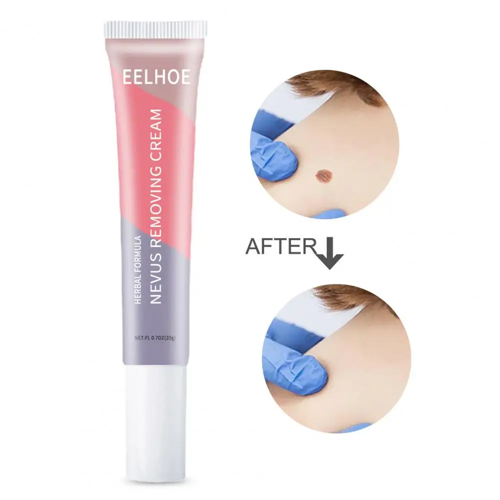 Mole Removal Cream