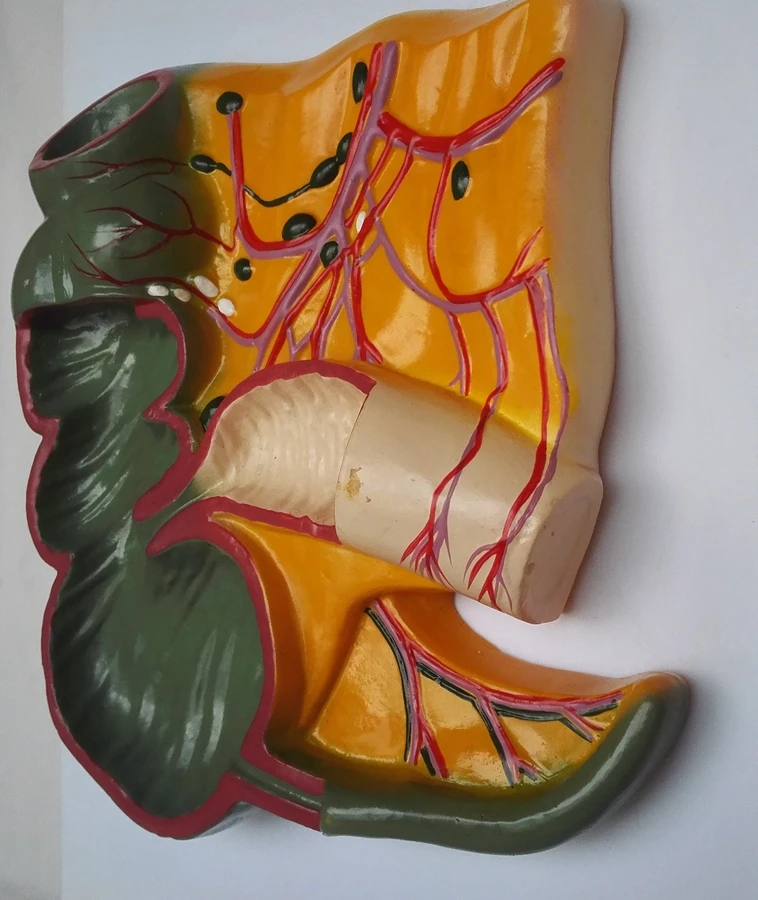 Human-Cecum-and-Appendix-Model-Ileum-Model-Lymphatic-and ...