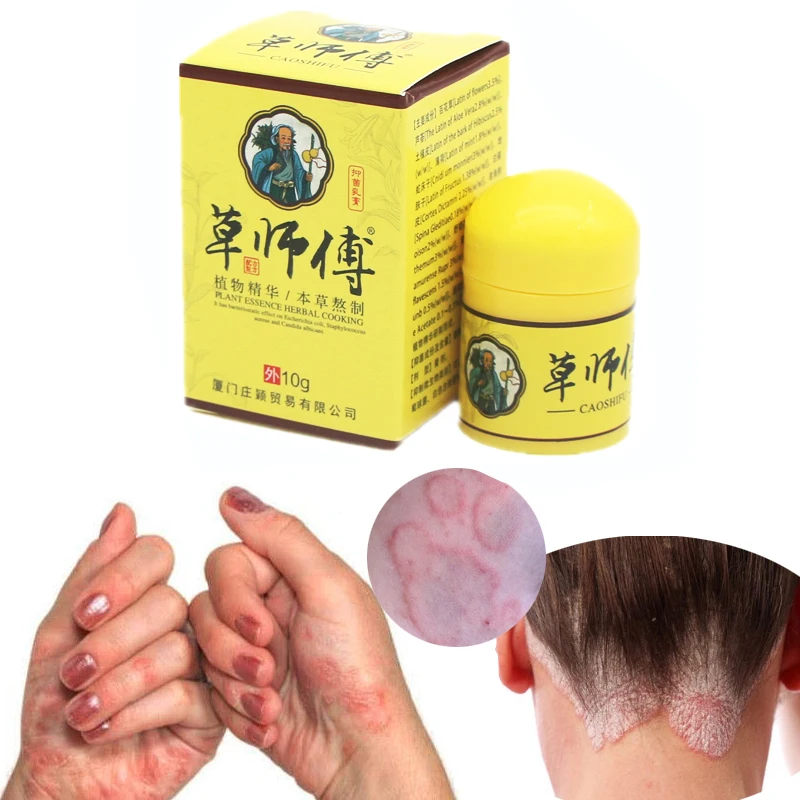 peligroso aventuras Reanimar pomada decloban mejilla transportar viceversa