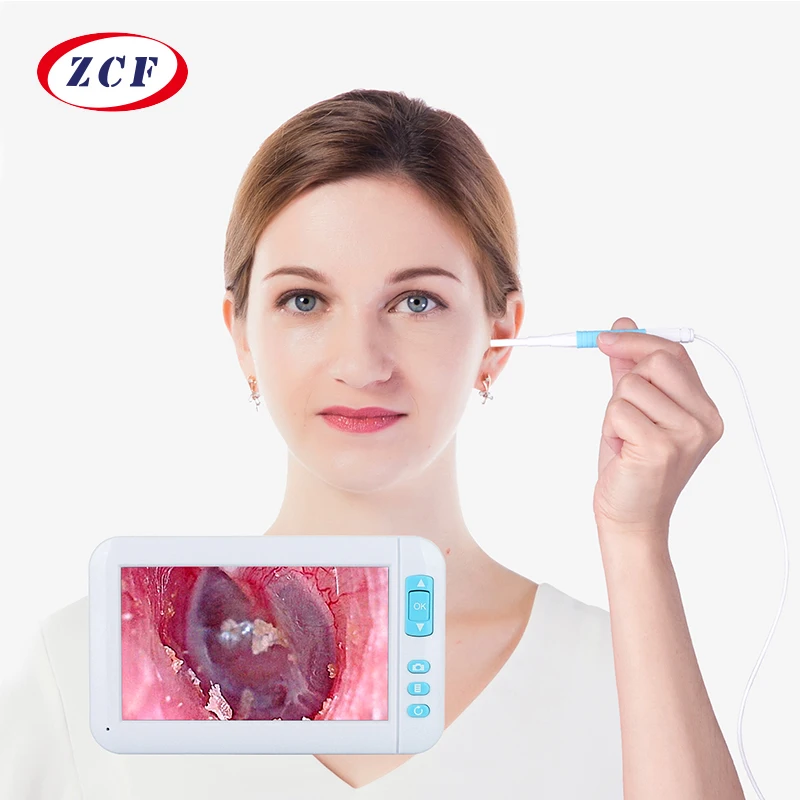 P20 HD1080P Ear Cleaner Screen Otoscope Endoscope Camera 3.9MM 4.3 inch ...