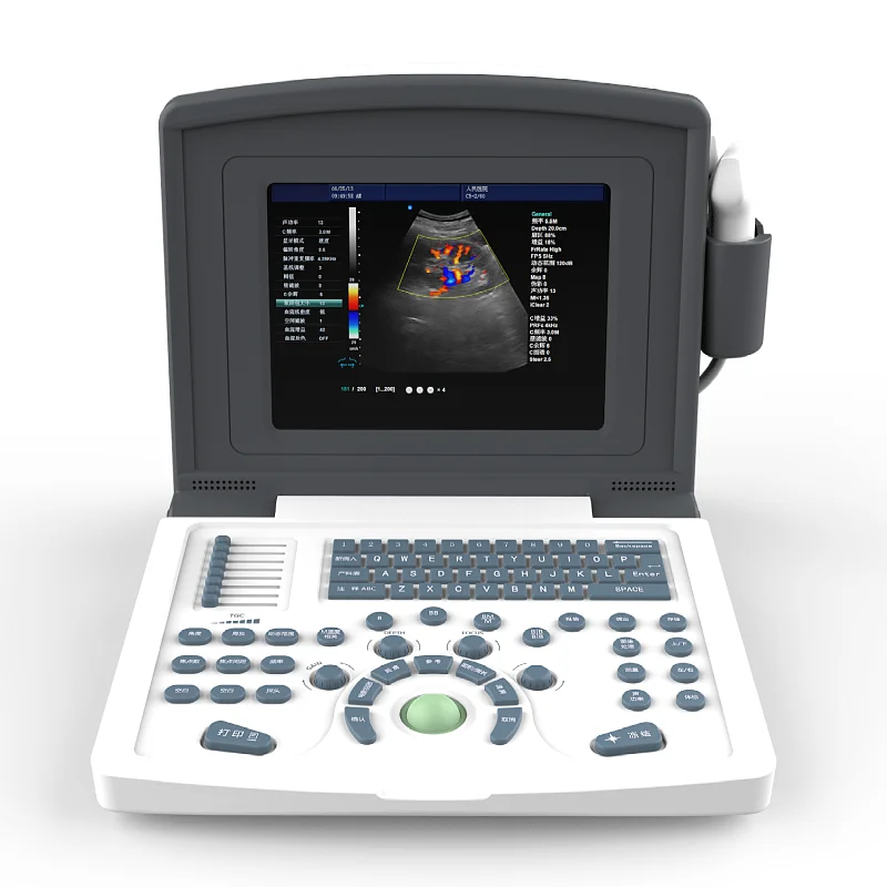 12-Inch-LED-Laptop-Portable-Color-Ultrasound-Scanner-Echo-Machine.png