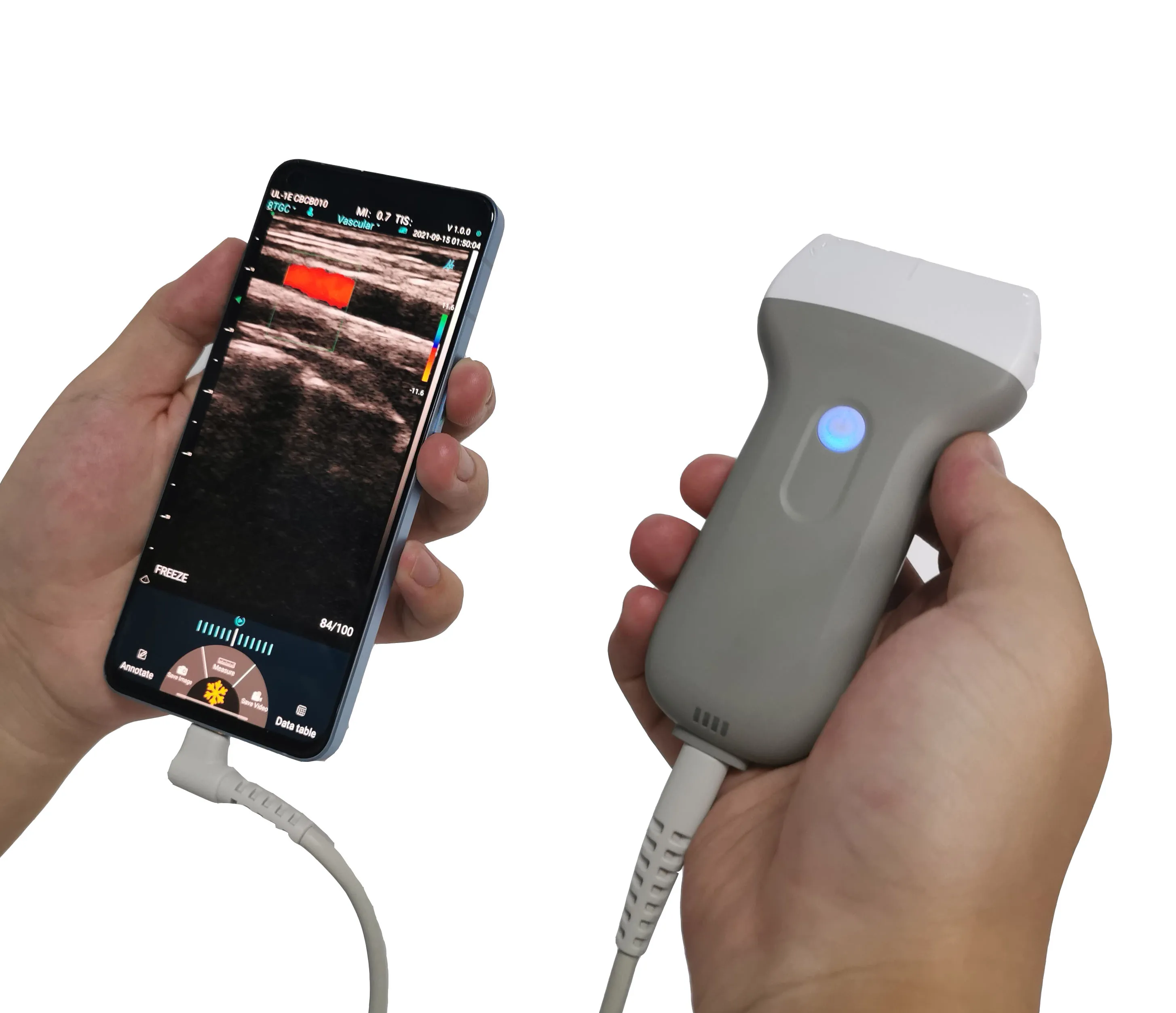 Sonda-de-ultrassom-sem-fio-Color-Doppler-com-Wi-Fi-transdutor-convexo ...