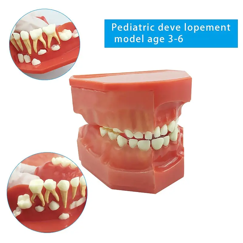 Dental Oral Teaching Model Children's Primary And Permanent Teeth ...