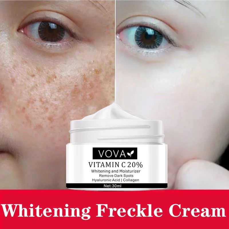VOVA Vitamin C 20% Whitening and Moisturizer Remove Dark Spots ...