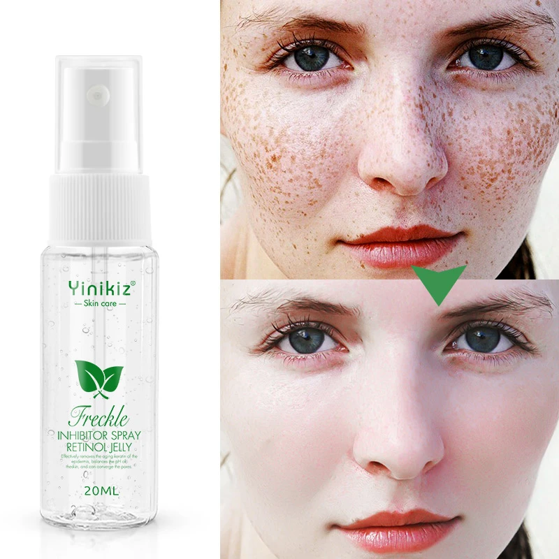 Freckle Inhibition Whitening Cream Spray Moisturizing Remove Melasma ...