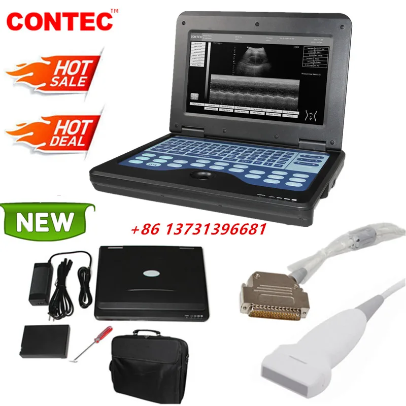 CONTEC Brand New Digital Portable Laptop Ultrasound Scanner Machine ...