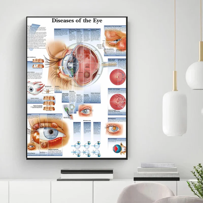 Eye Diseases Chart