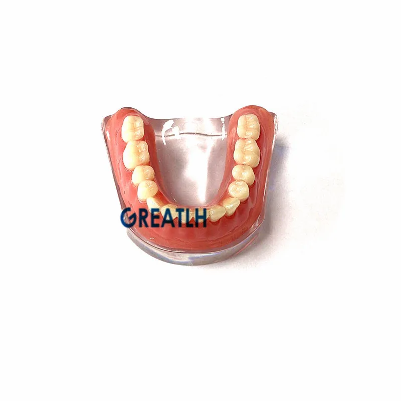 6pcs-pack-mandibular-model-with-Silver-bar-Overdenture-implant-model ...