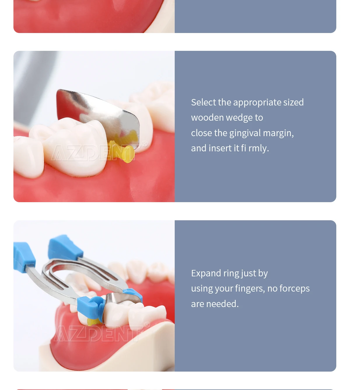 Azdent Dental Matrix Sectional Contoured Metal Spring Clip Rings Clamps ...