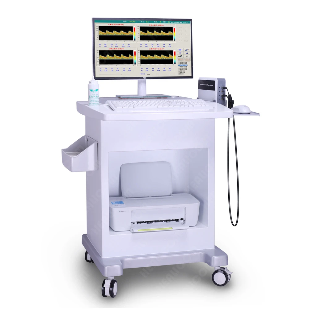 Transcranial Doppler Equipment