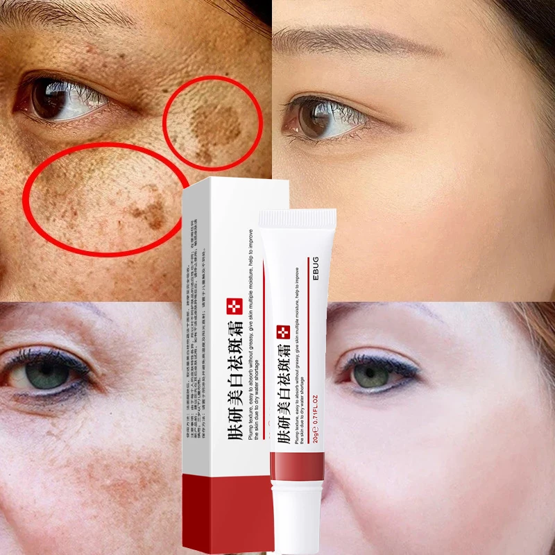 효과적인 미백 주근깨 크림 다크 스팟 제거 주근깨 방지 크림 페이드 색소 침착 기미 브라이트닝 크림 스킨 케어 20g