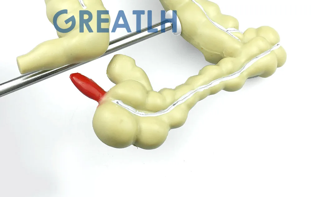 Colorectal Lesion Model Human Colon Snake Large Intestine Pathological ...