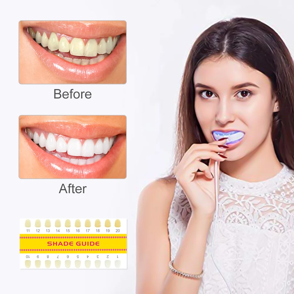 Luxsmile-Home-Use-Dental-Peroxide-Teeth-Whitening-Kit-Tooth-Bleaching ...