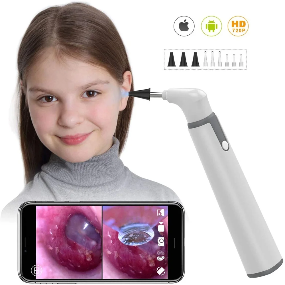 Wireless Otoscope Ear Camera 3.9mm 720p Hd Wifi Ear Scope With 6 Led ...