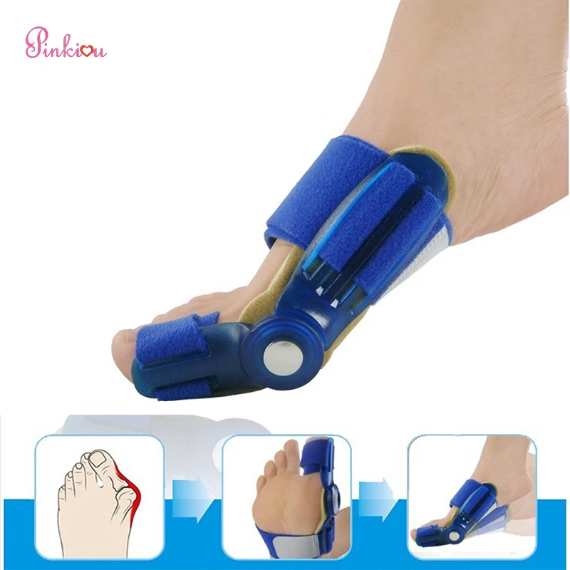 Generic 1 Pair Orthotics Braces Big Bone Toe Hallux Valgus Foot Pain ...