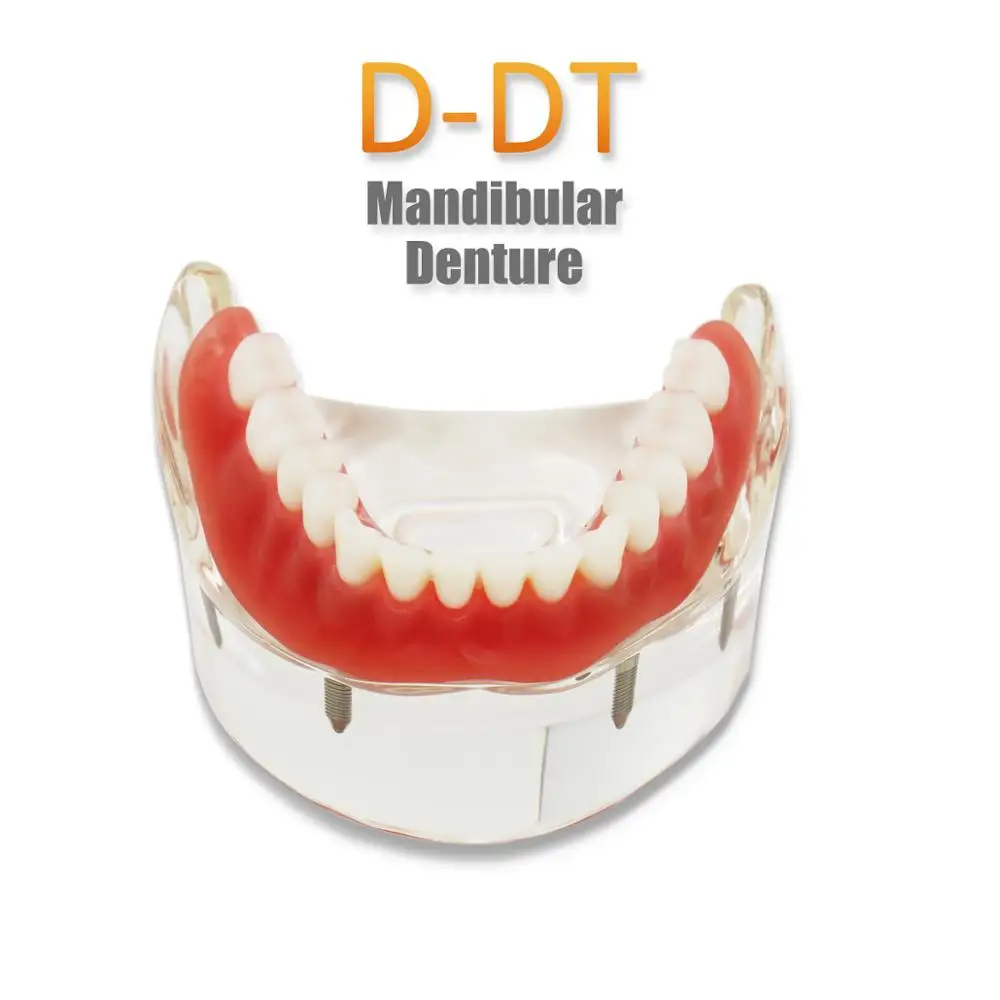 D-DT-Lower-jaw-Dental-Study-Teaching-Model-Dental-Impant-Standard-Model ...