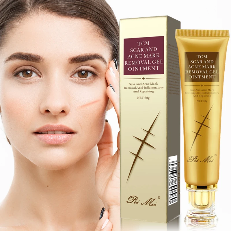 Acne Scars Removal Products