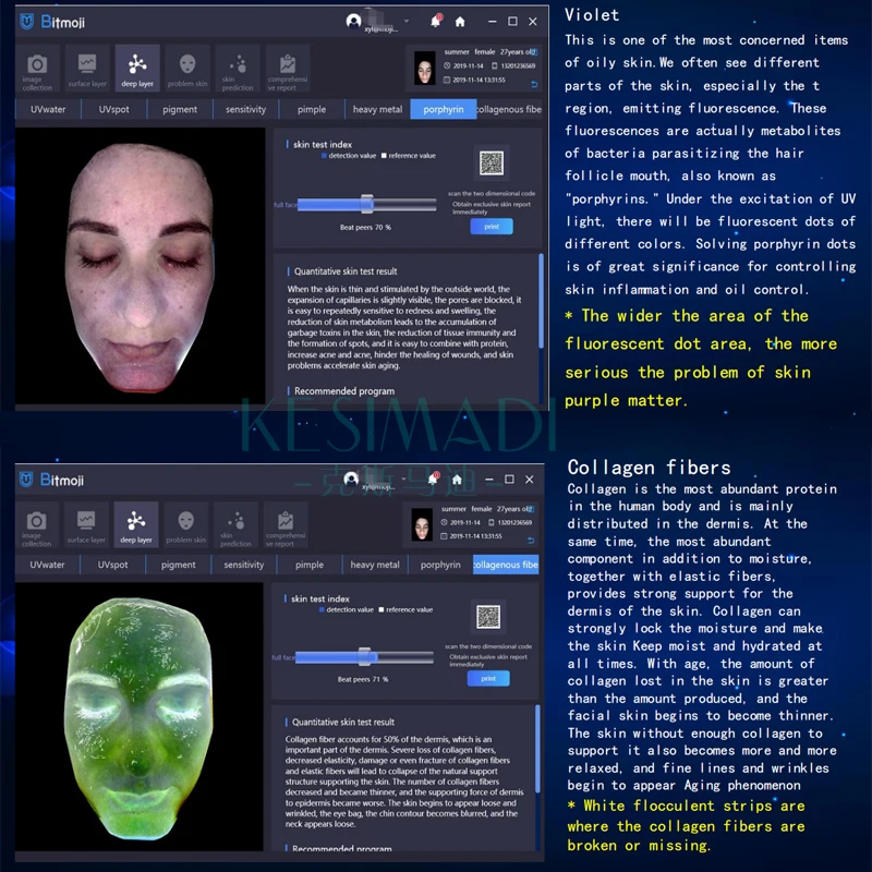 Portable Magic Mirror for 3D Smart Professional Skin Detection Analyzer ...