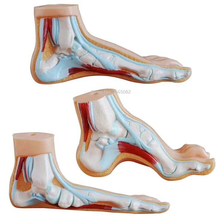 Human-Foot-Model-Foot-Muscles-Flatfoot-Talipes-Cavus-Bow-Foot-Model ...