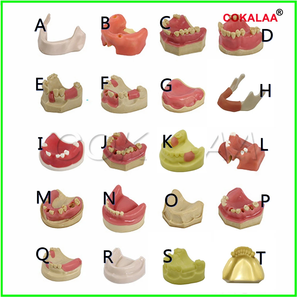 1PCS Dental Mandibular Demonstration Oral Model Implant Practice ...