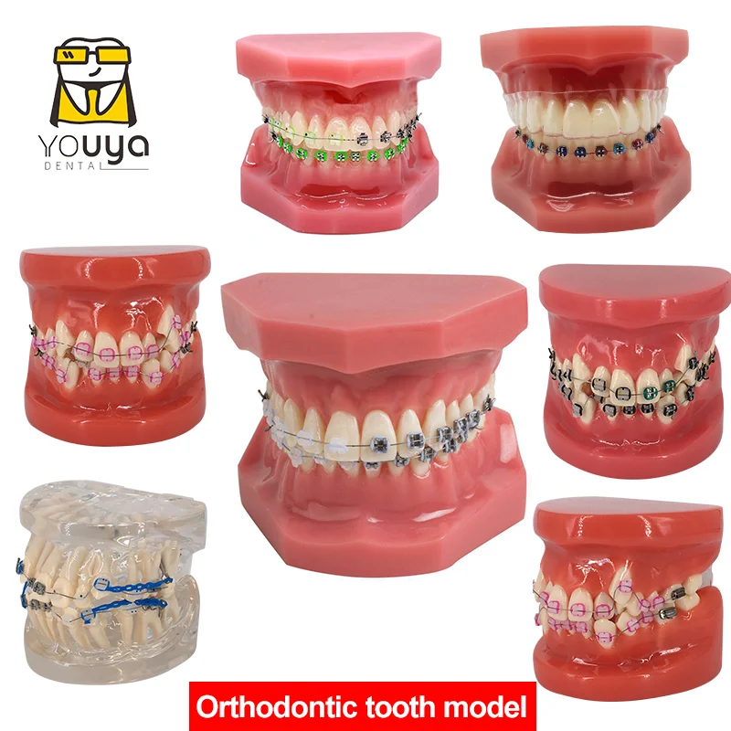 Dental Model With Braces Dentistry Materials Orthodontic Models Gum ...