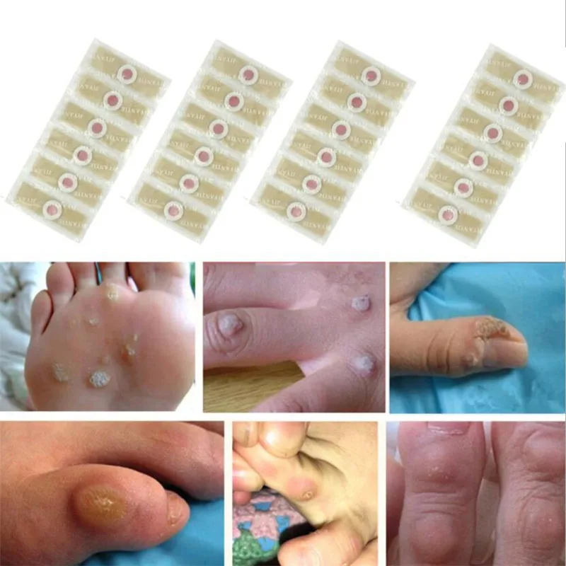 48pcs-set-Foot-Care-Stickers-Medical-Plaster-Chicken-Eye-Corns-Patches ...