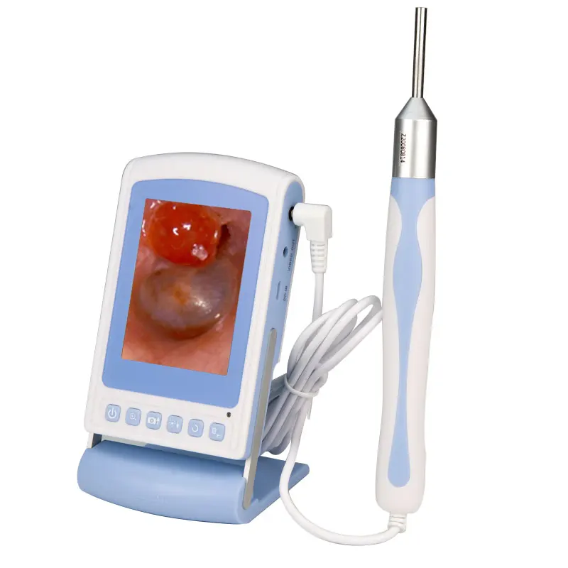 3-9mm-USB-Digital-Microscope-Otoscope-Ear-Endoscope-Nose-Throat ...