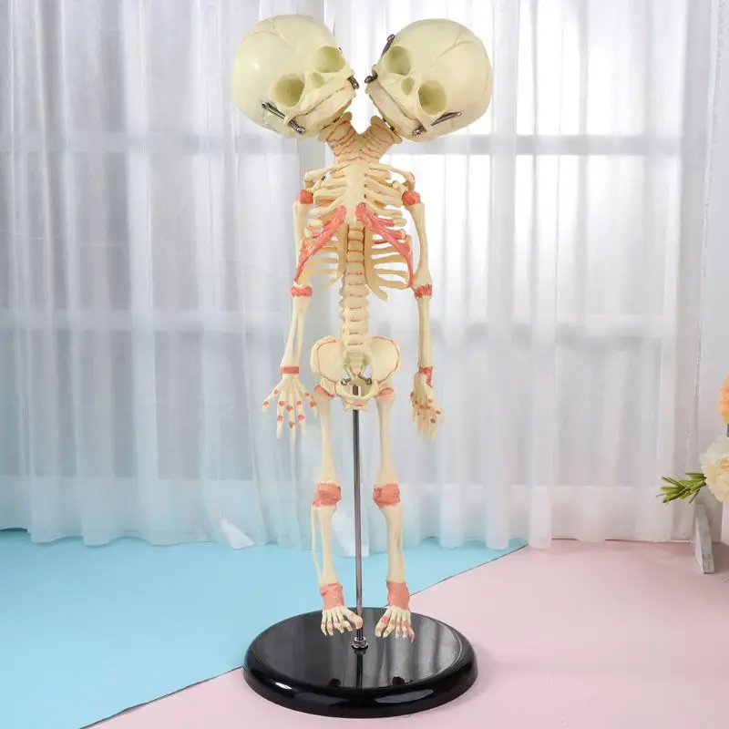 Promo 37cm Human Double Head Baby Skull Skeleton Anatomy Brain Display ...