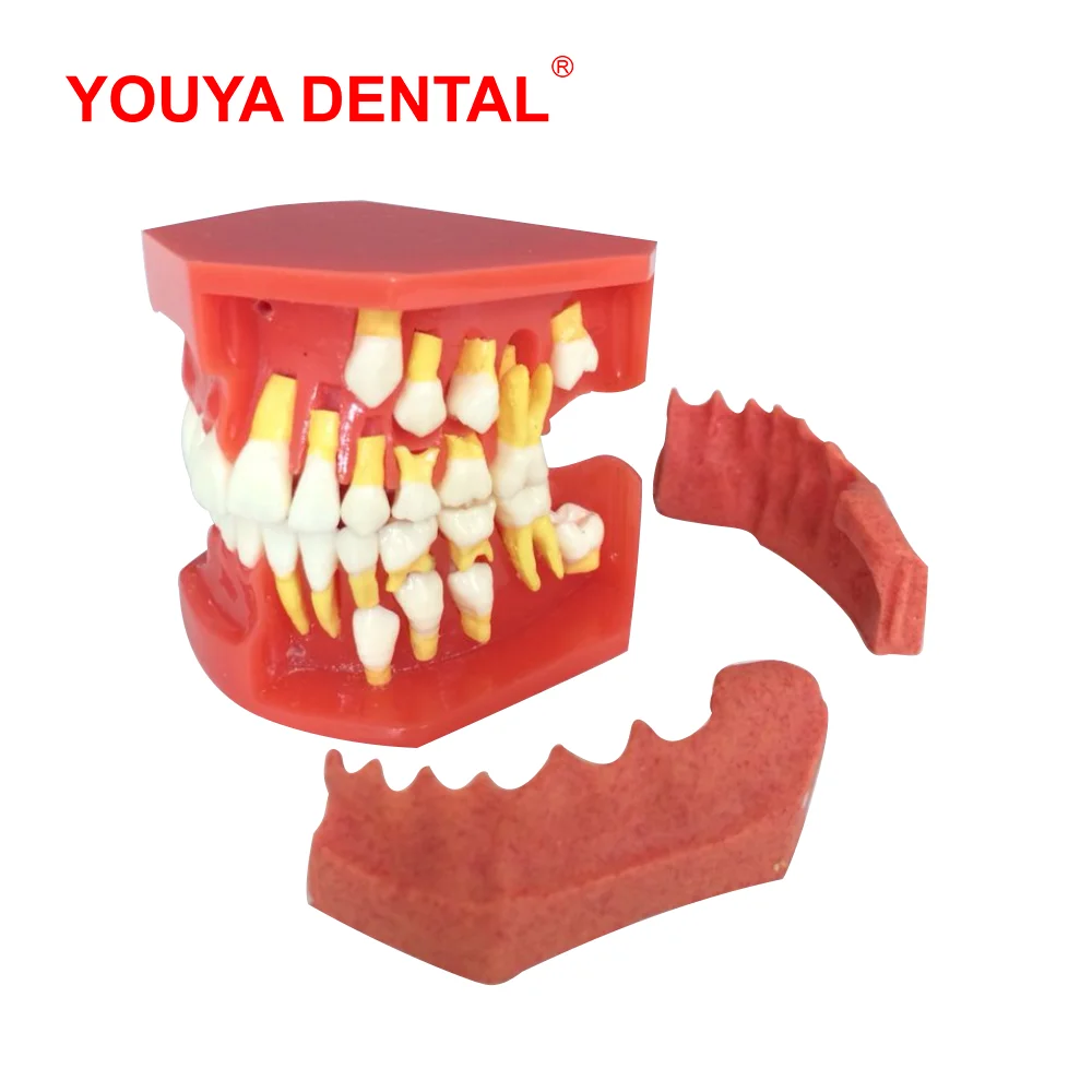Dental-Model-Resin-Children-Primary-Permanent-Tooth-Model-Alternative ...