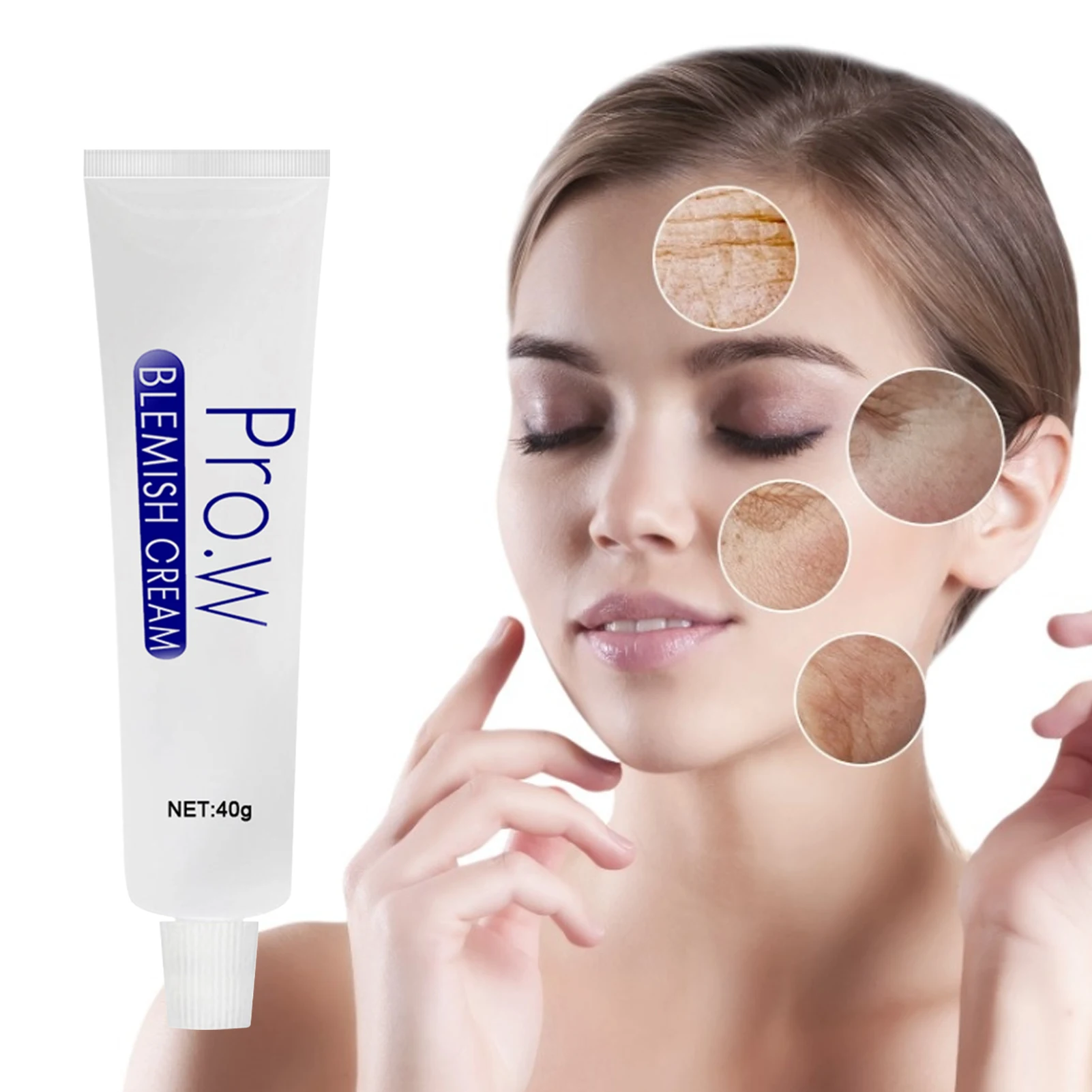 Blackheads Removal Cream