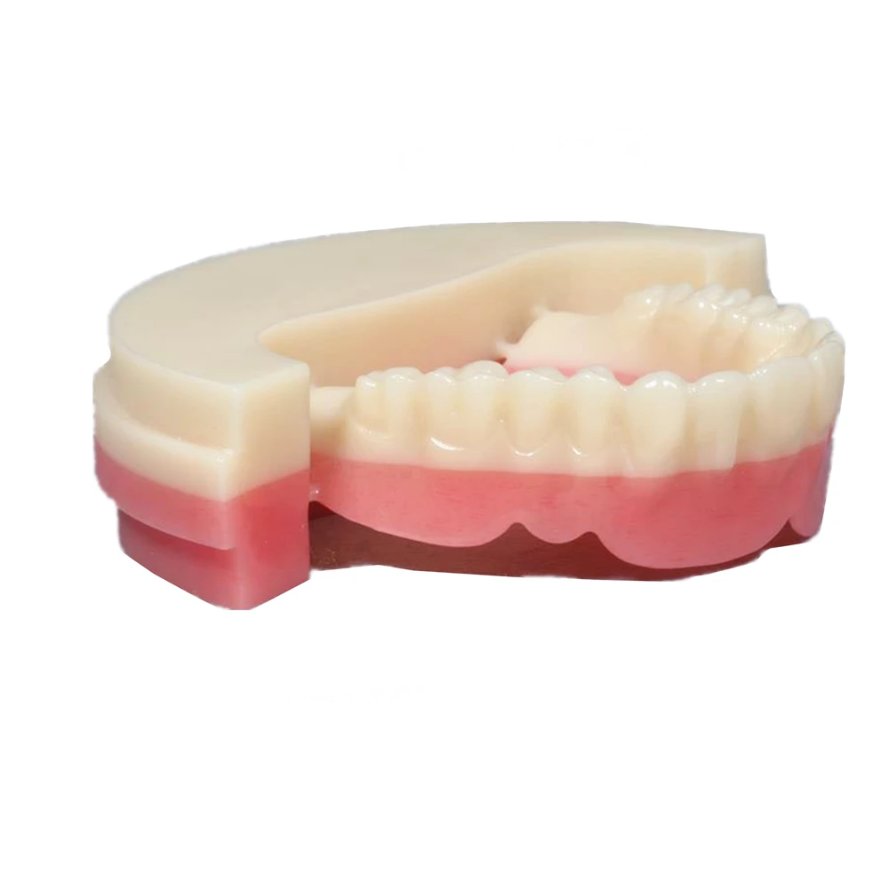 A2-A3-color-CADCAM-Full-Denture-Pink-PMMA-disc-Dental-material-Full ...