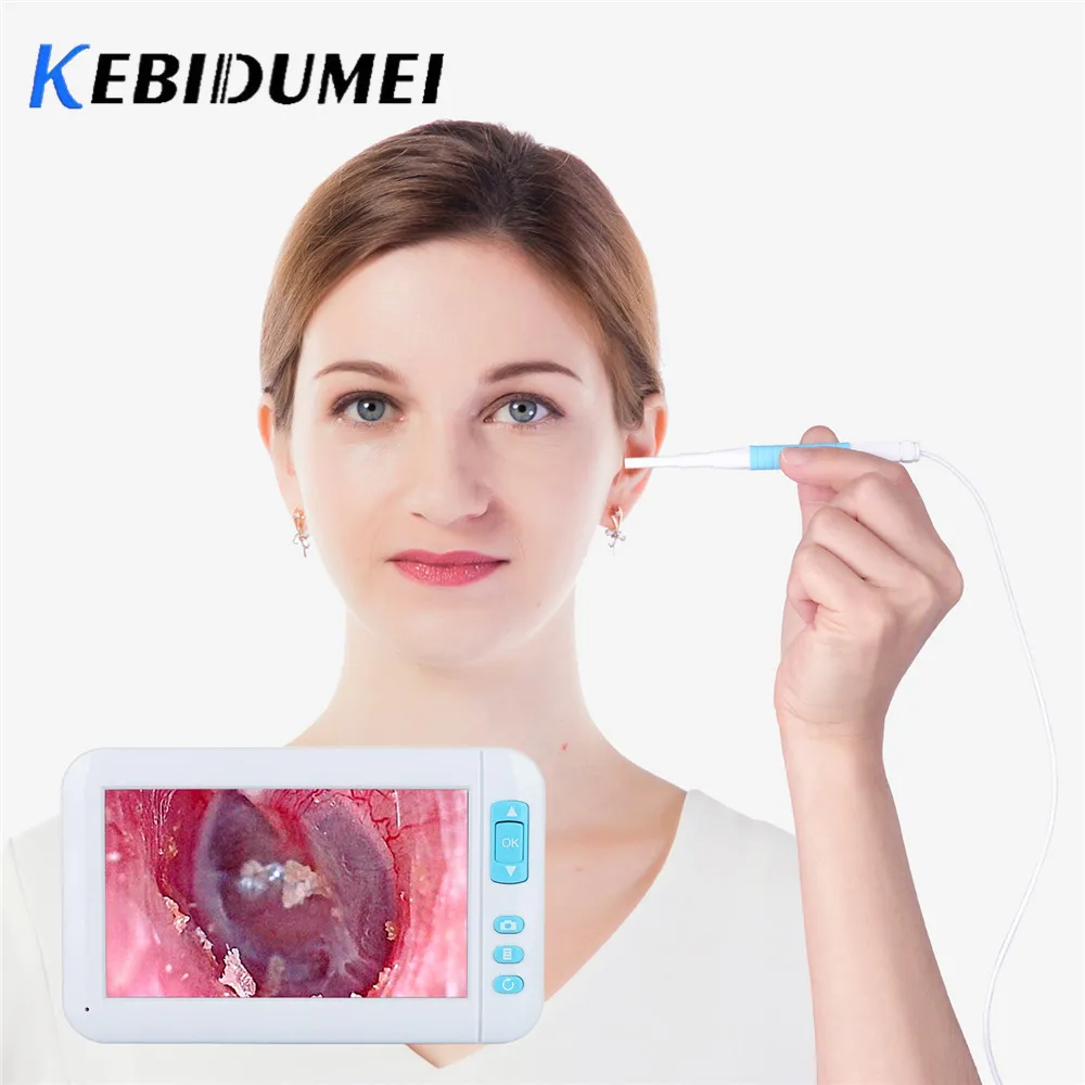 Otoscope эндоскоп камера HD экран 3,9 мм Лен 1080P диагностический ...