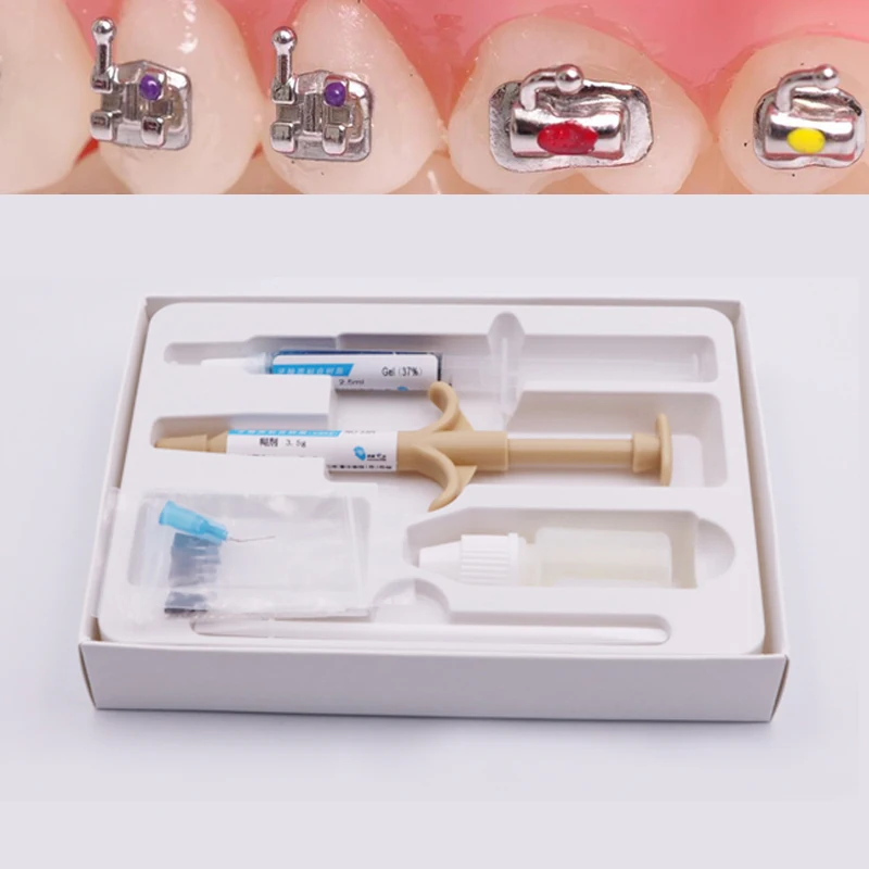 NSKLED Dental Orthodontic Direct Paste Adhesive Bonding Self Curing ...