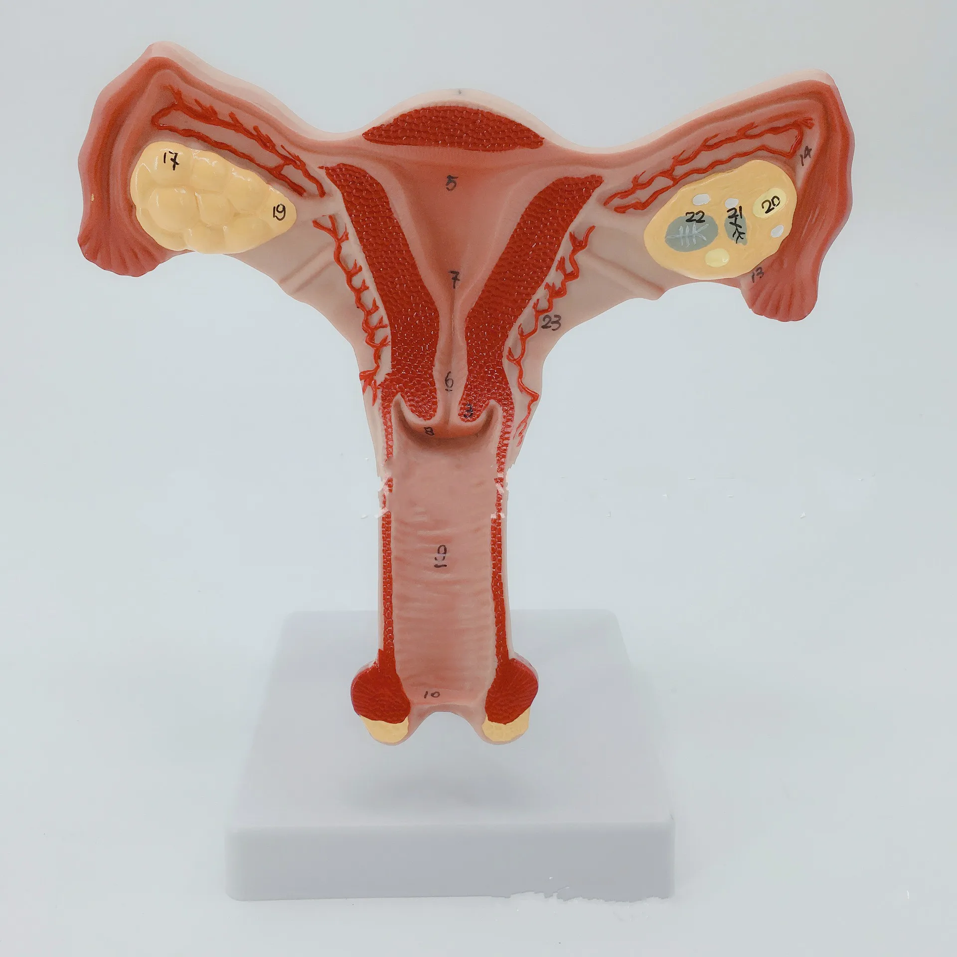 Uterus Model Labeled