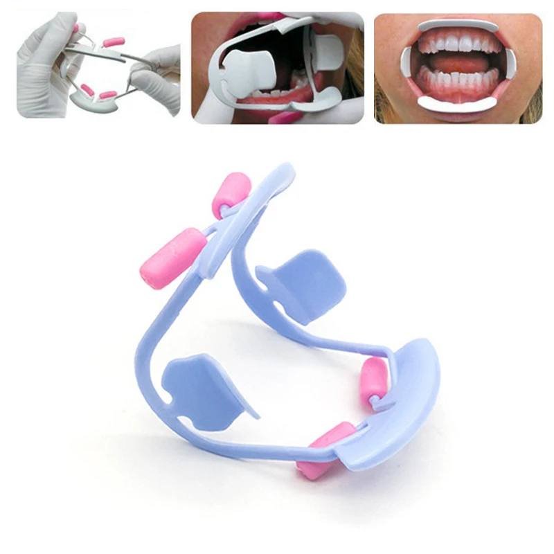 2pcs Dental Mouth Opener 3D Oral Cheeck Lip Retractor Prop Orthodontic ...