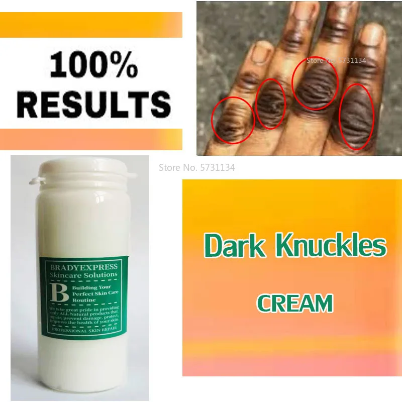Dark Knuckles Cream, Very Strong Cream , Dark Spots Remover, Fast ...
