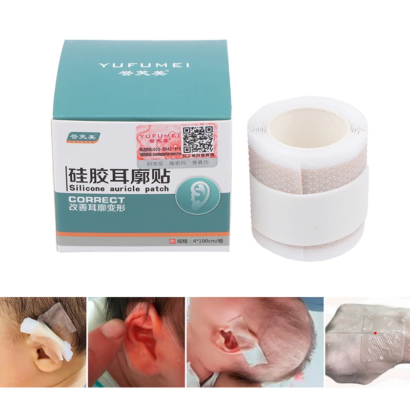 Silicone Tape Child Infant Baby Ear Correction Personal Health Care Ear ...