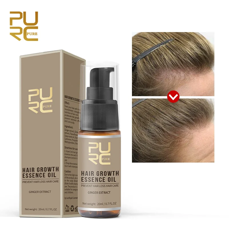 PURC-Hair-Growth-Oil-Ginger-Extract-Essence-Thickener-Prevent-Hair-Loss ...